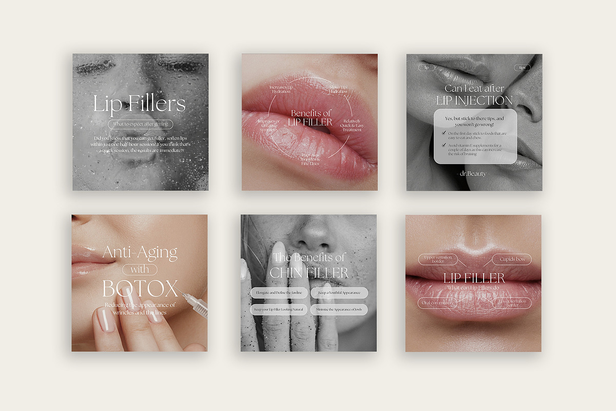 200 Botox and Lip Fillers Canvas Instagram Templates