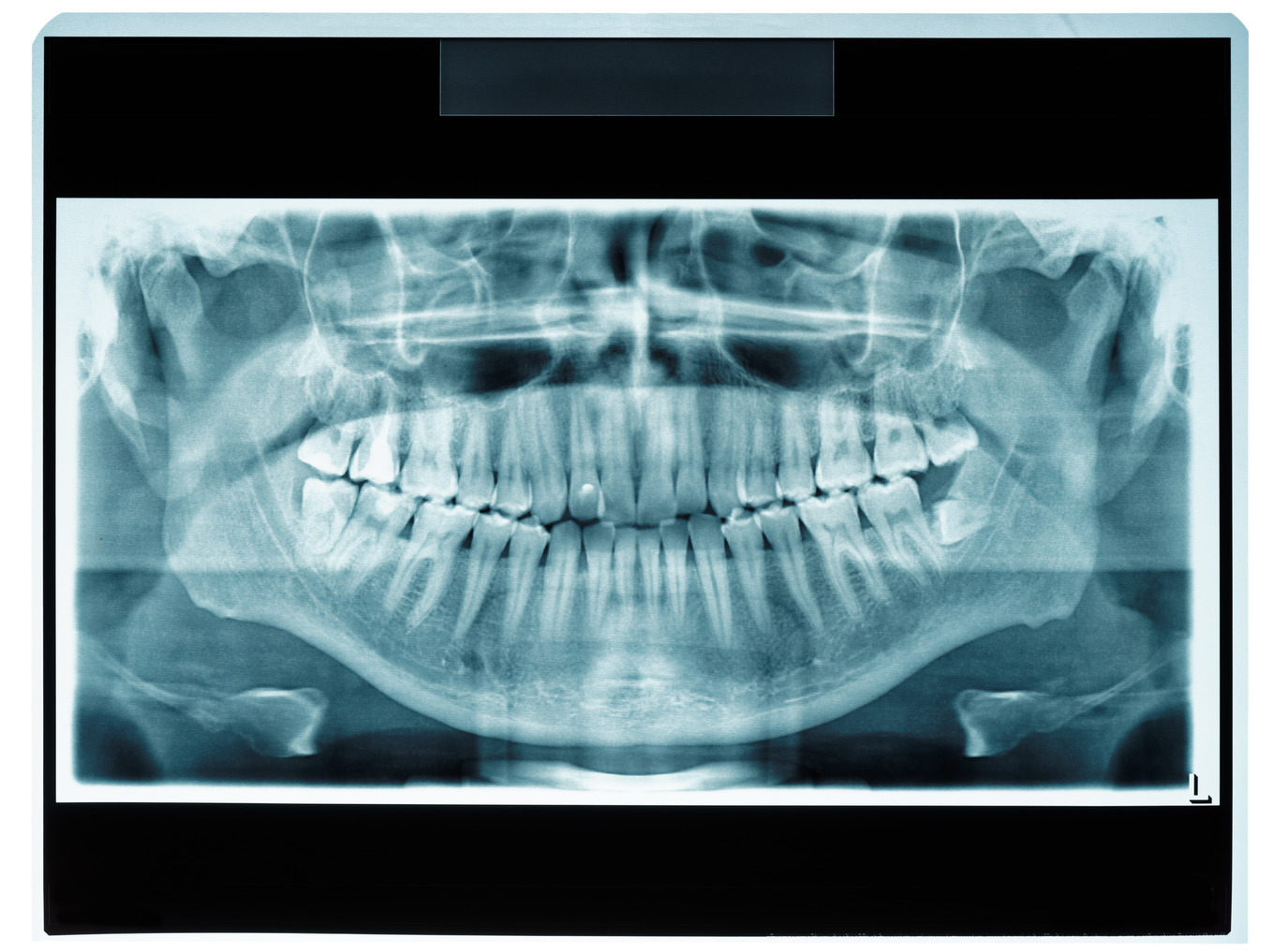 Panoramic dental X-ray, a Health & Medical Photo by Theo's Stuff
