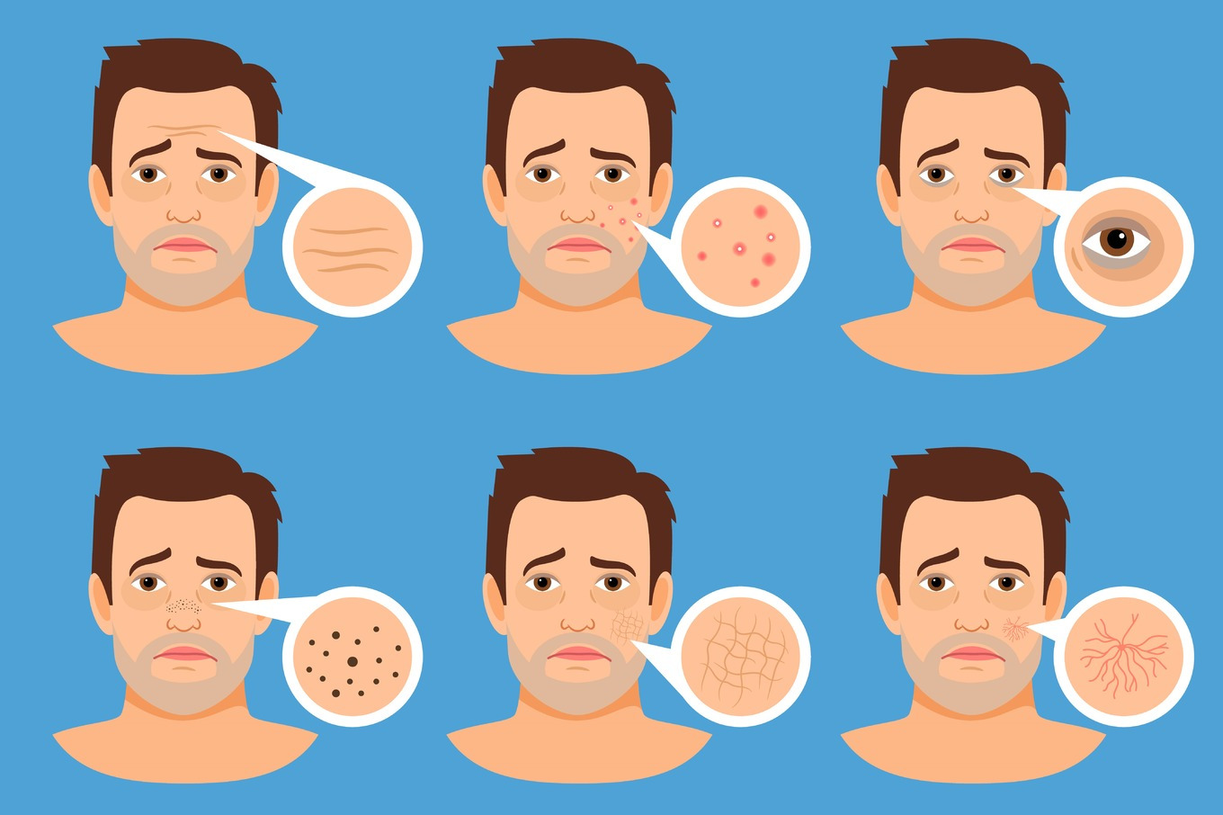 Man skin problems illustration, an Object Graphic by Stock-Smart-Start
