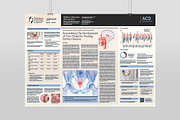 Case Study Research Poster Template, a Poster Template by BrandPacks ...