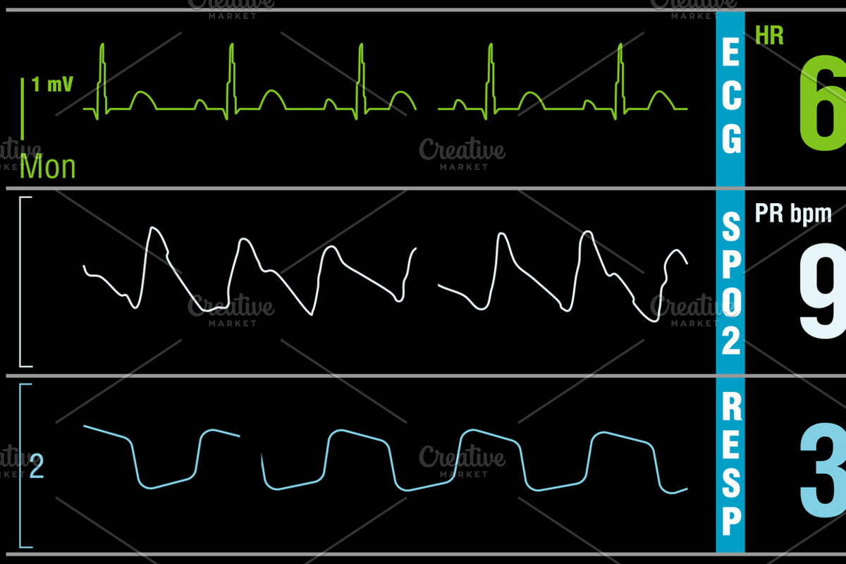 Patient monitor displays medical exam vital signs, a Healthcare ...