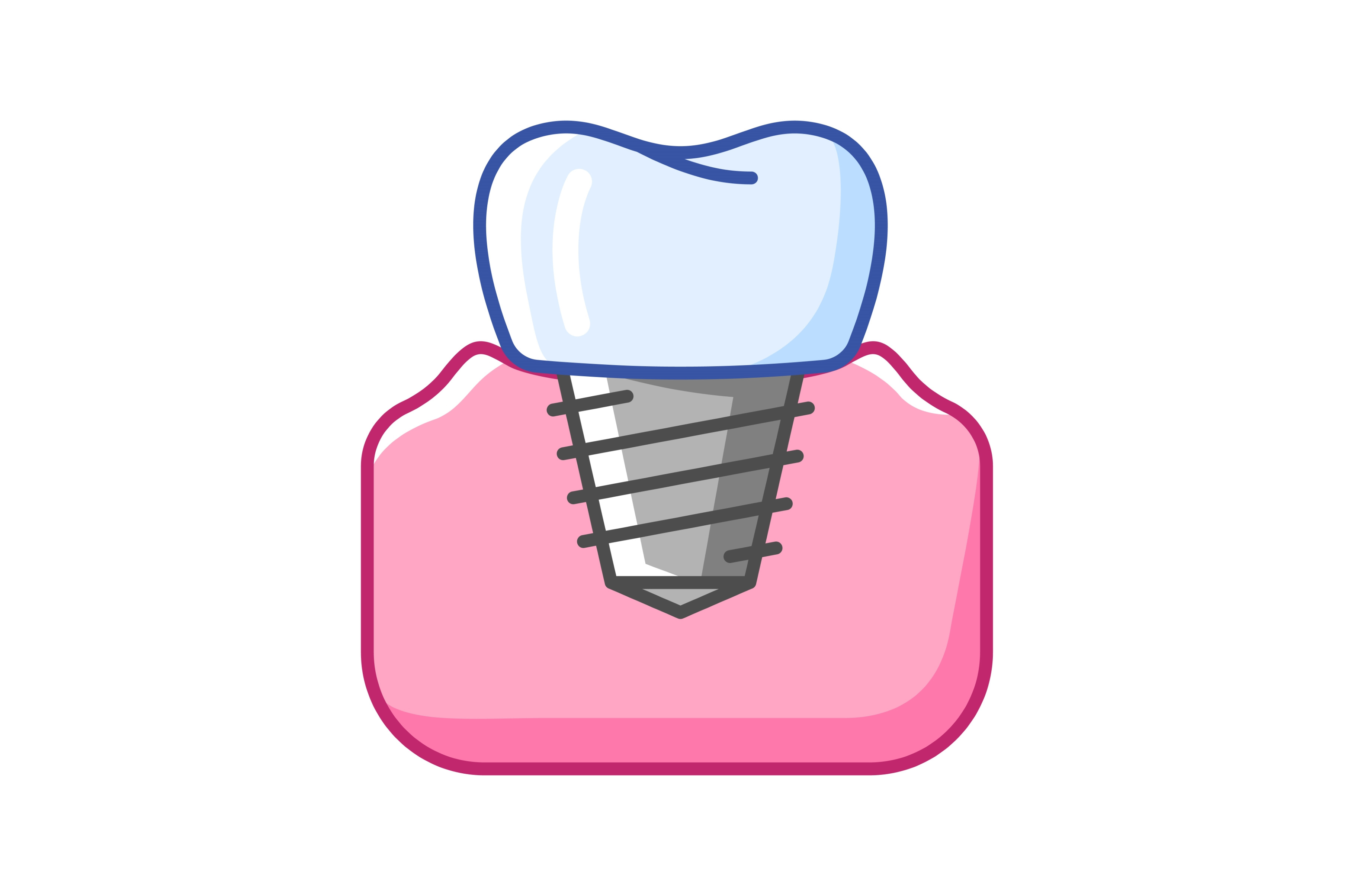 Illustration of dental implant, a Healthcare Illustration by incomible