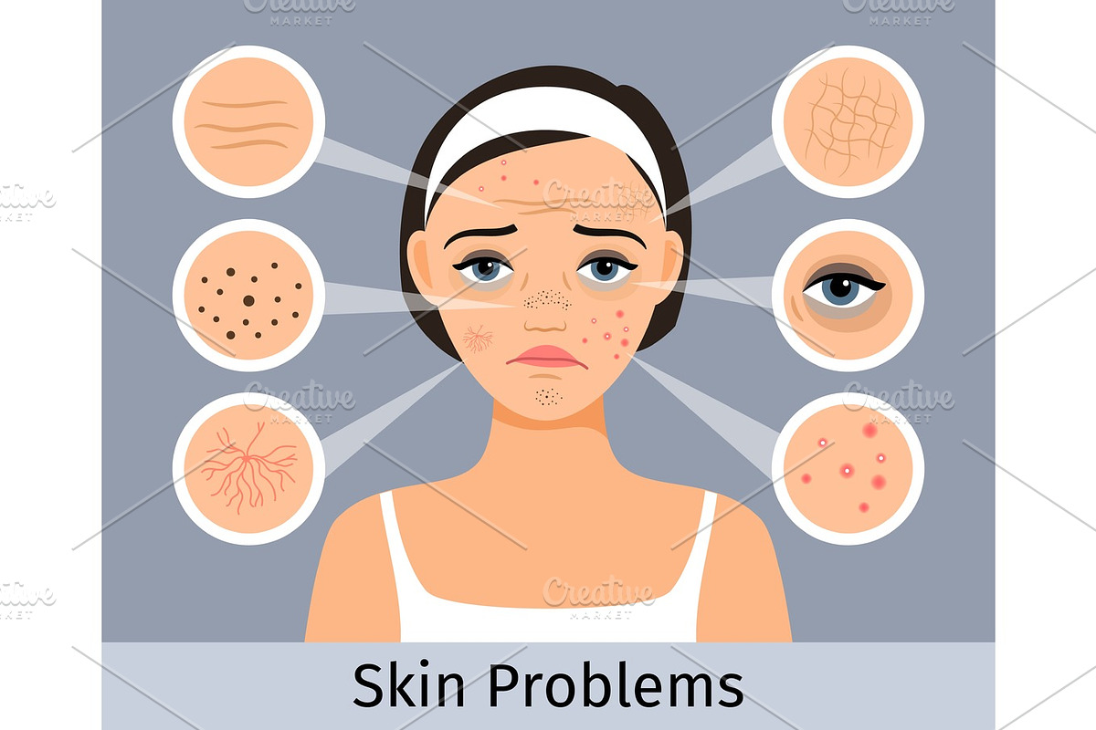 Girl face with skin problems, a Healthcare Illustration by Stock-Smart ...