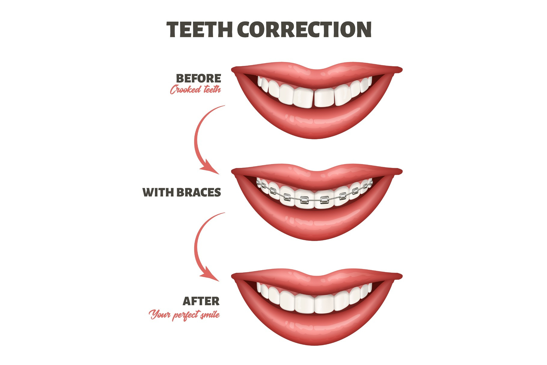 Medical poster showing a teeth, an Object Graphic by Woters little shop