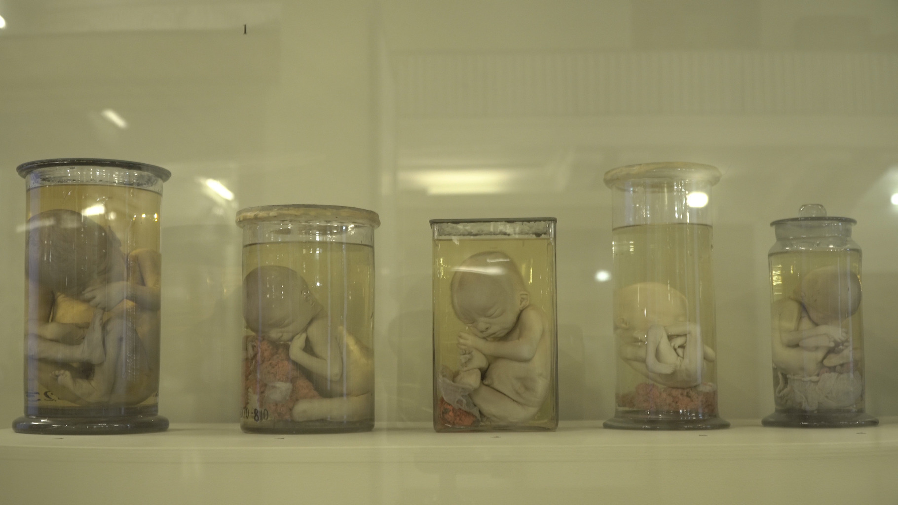Anatomical human specimens in formalin featuring remains, lab, and body ...