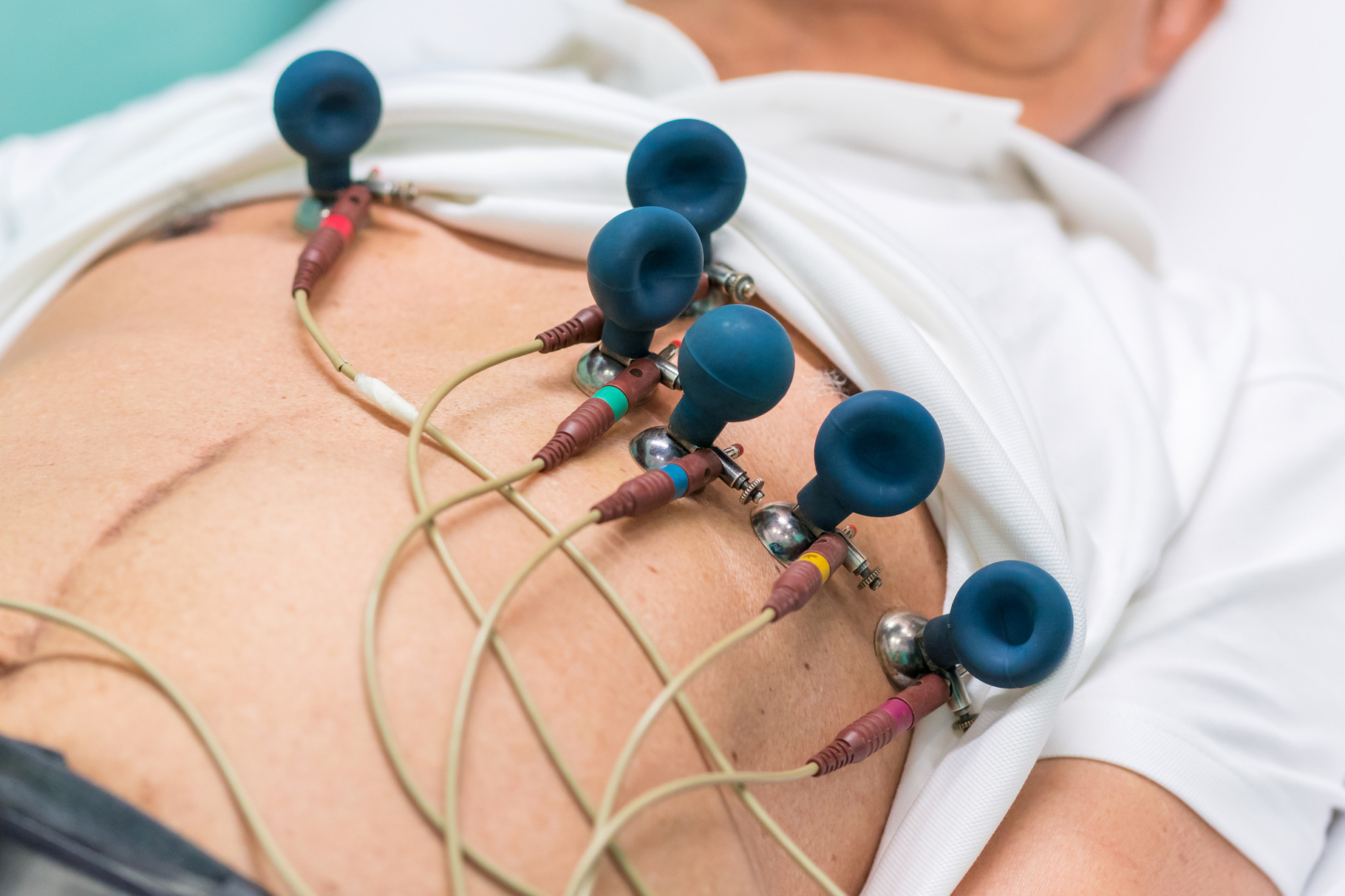 Ecg or ekg legs of man with electrod featuring ecg, electrocardiogram ...