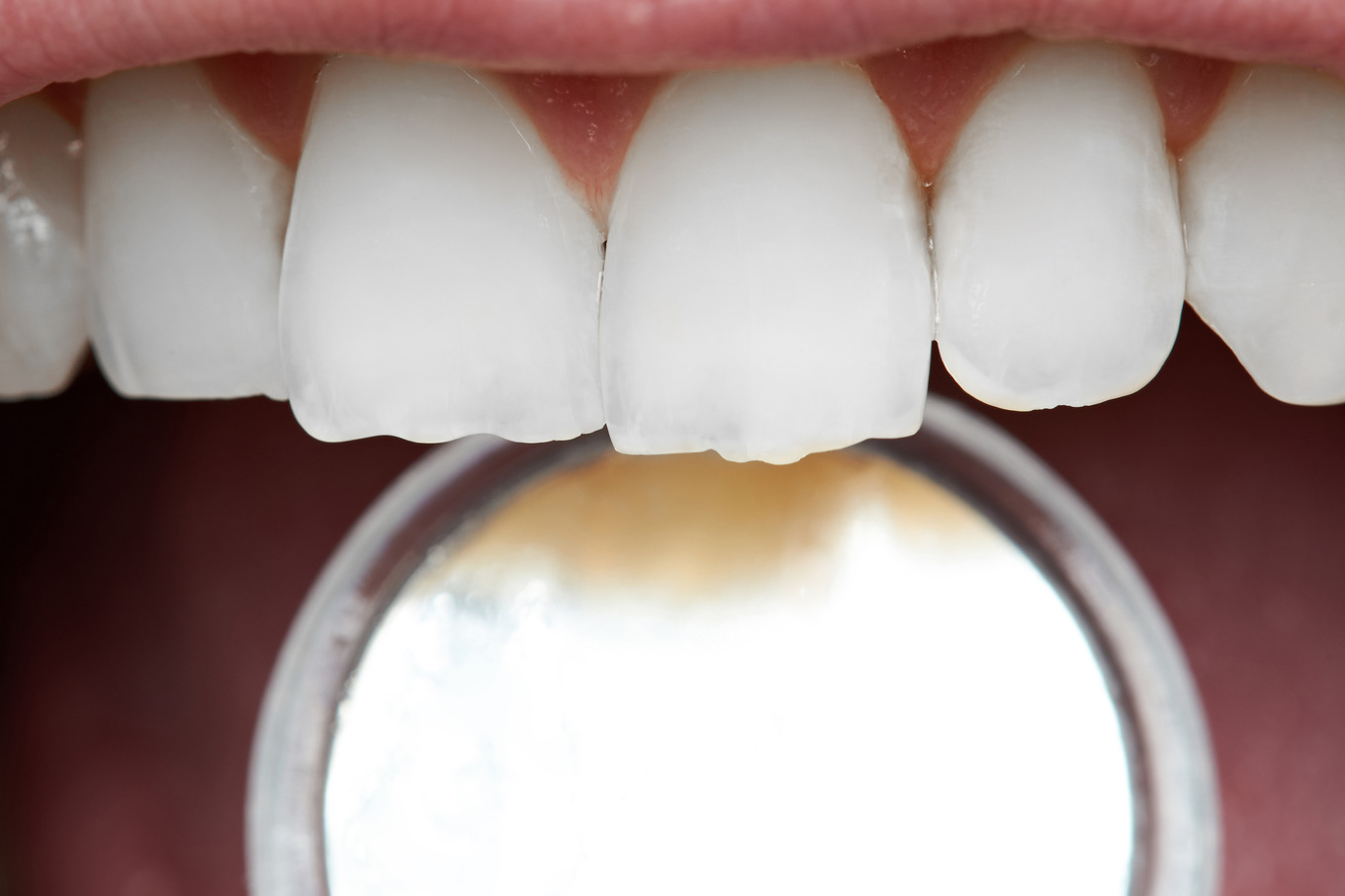 Close-up of human front teeth, a Health & Medical Photo by PixieMe