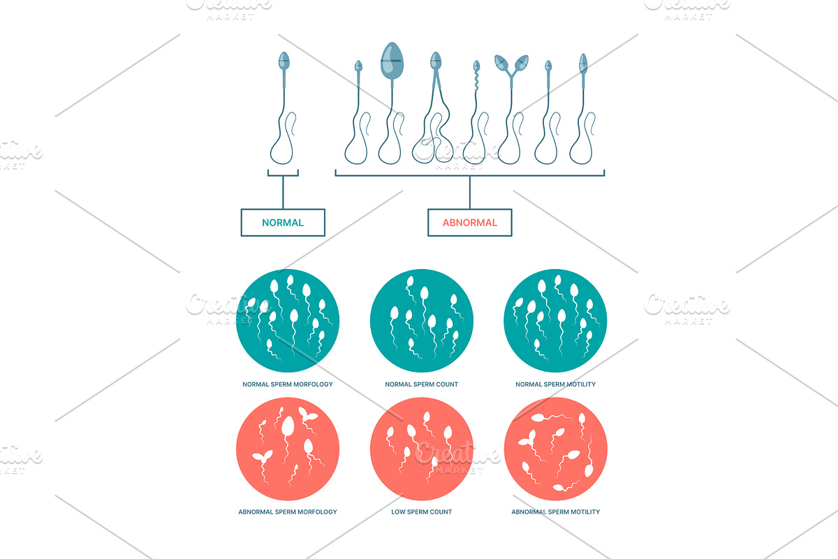 Spermogram. Medical infographic with, a Background Graphic by Onyx