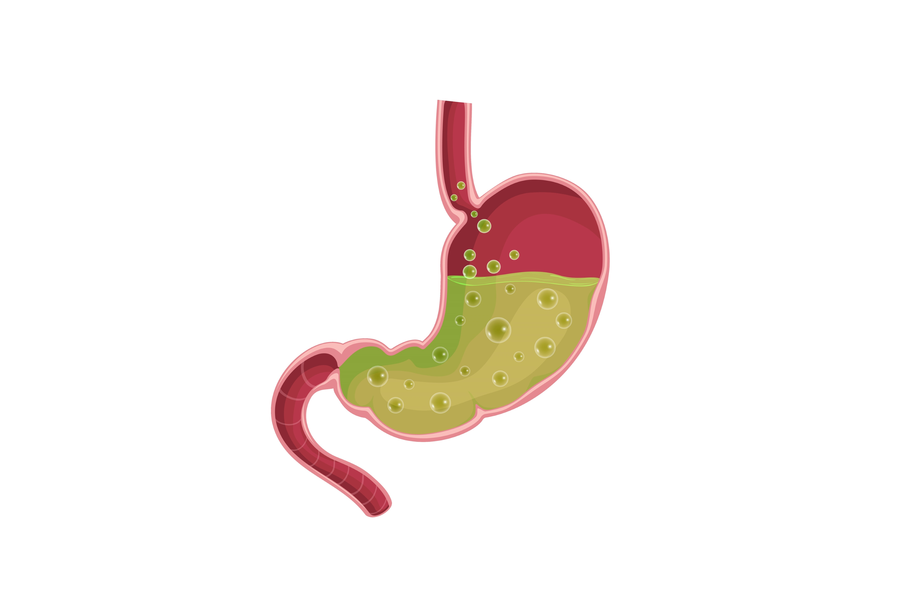 Stomach. Nausea. Vomiting, an Object Graphic by piter.goskov | Creative ...
