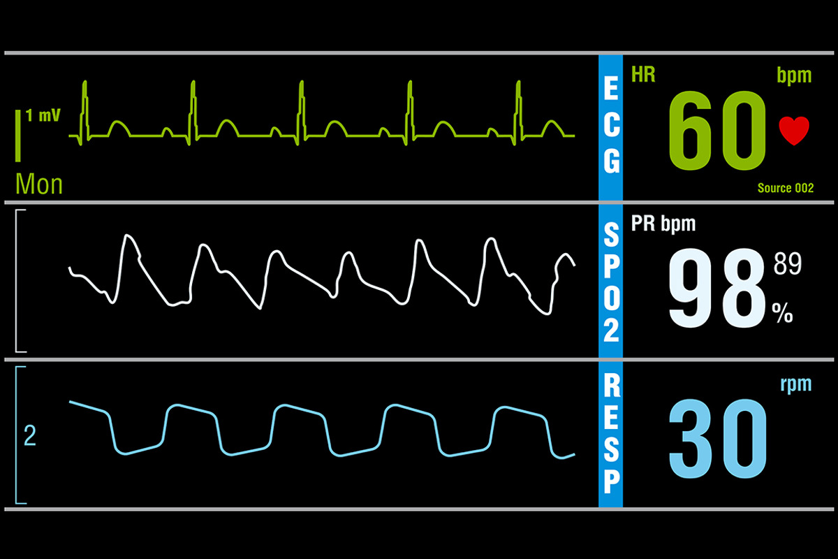 Patient monitor displays vital signs, a Healthcare Illustration by ...