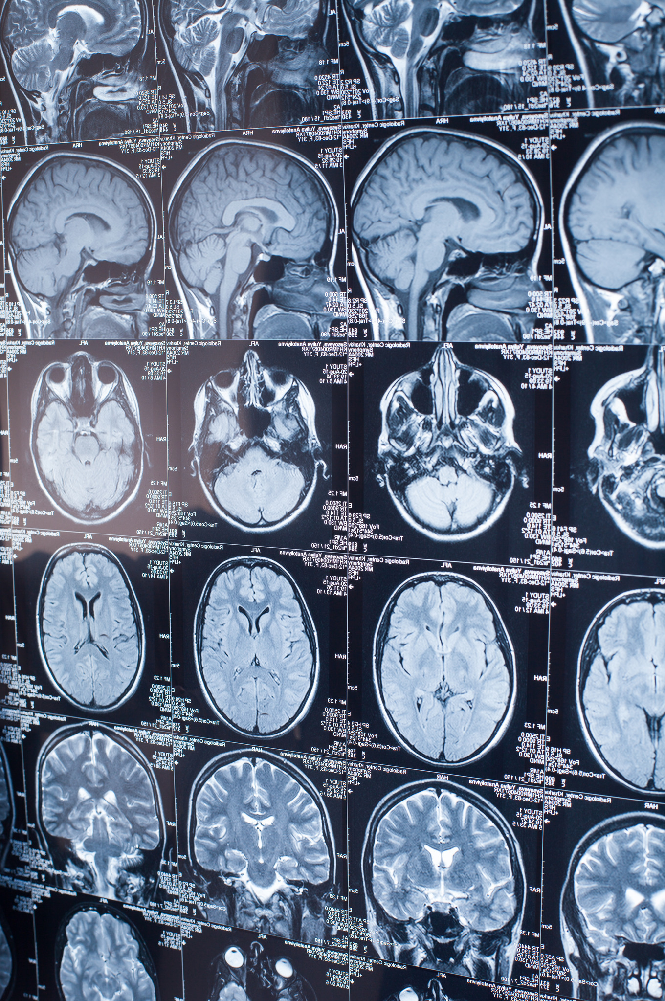 Mri diagnostics containing anatomy, health, and healthcare, a Health ...