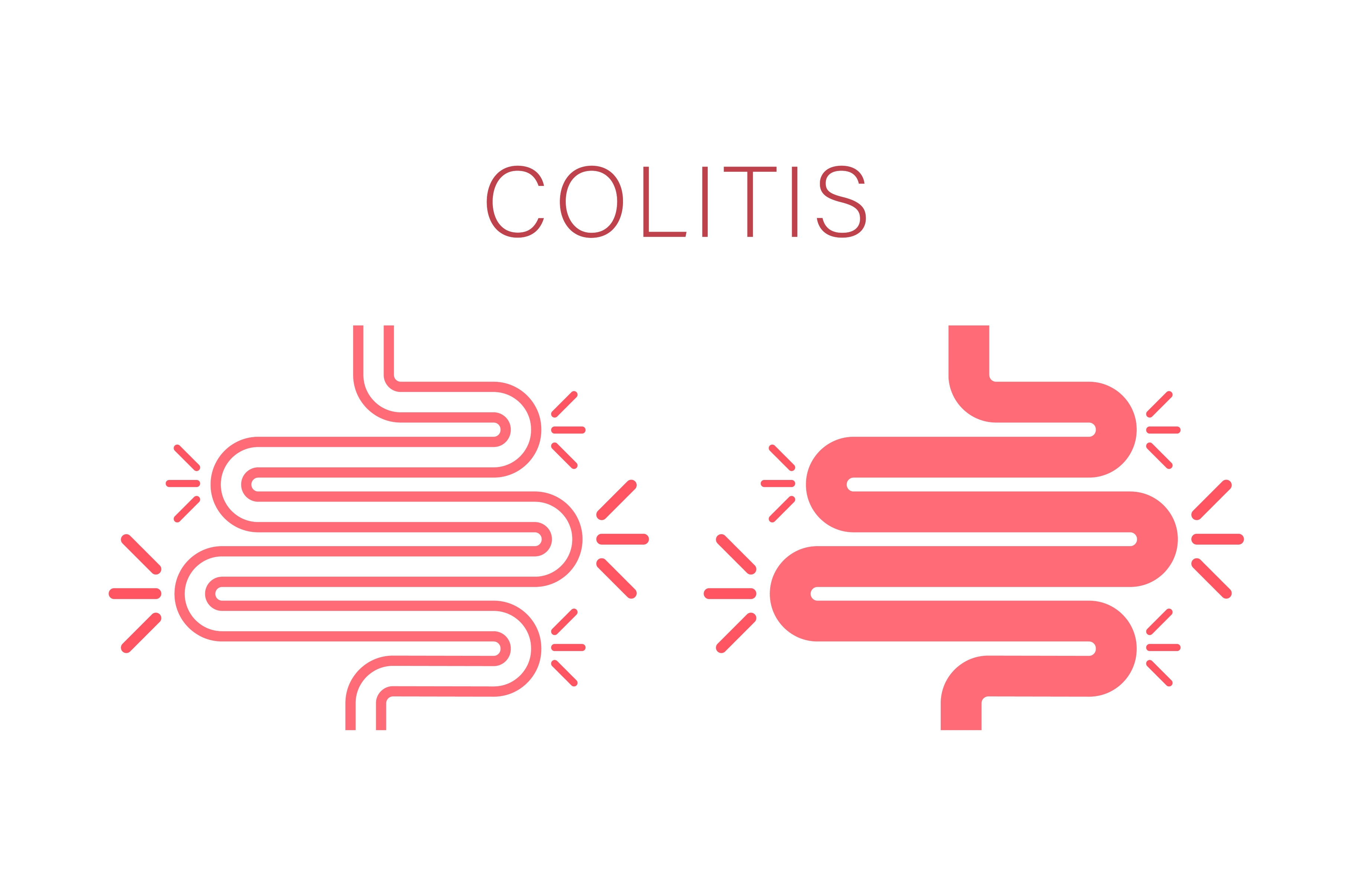 Colitis for medical design, a Healthcare Illustration by DG-Market