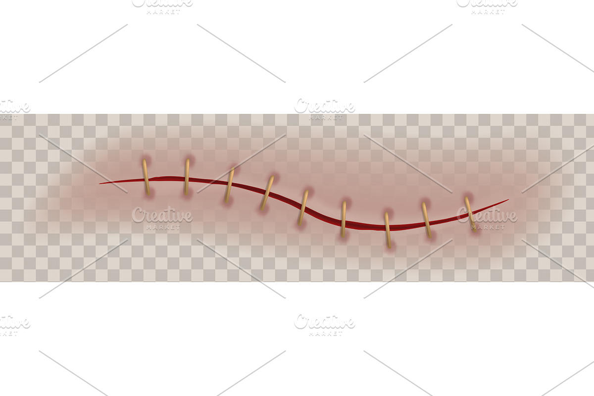 Realistic scar or wound. Bloody, an Object Graphic by YummyBuum