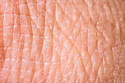 Texture of human skin containing skin, human, and texture | Abstract ...