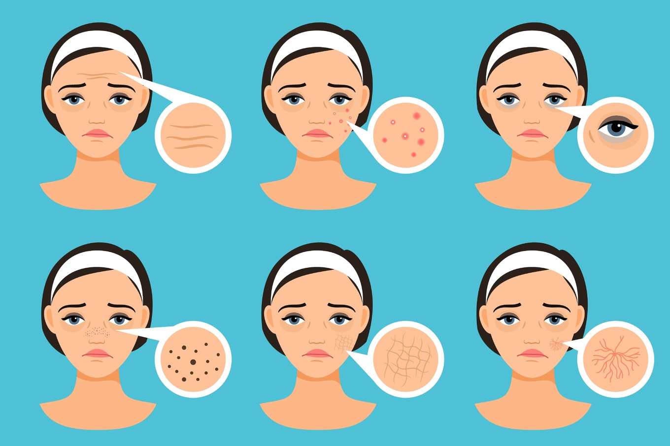 Female face with skin problems, a Healthcare Illustration by Stock ...