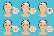 Female face with skin problems, a Healthcare Illustration by Stock ...