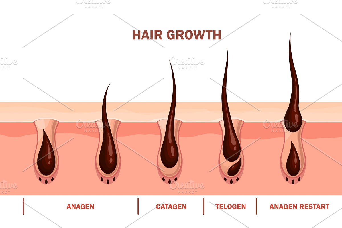 Hair growth cycle infographic, a Healthcare Illustration by Vector ...