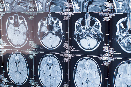 Mri diagnostics containing anatomy, health, and healthcare, a Health ...