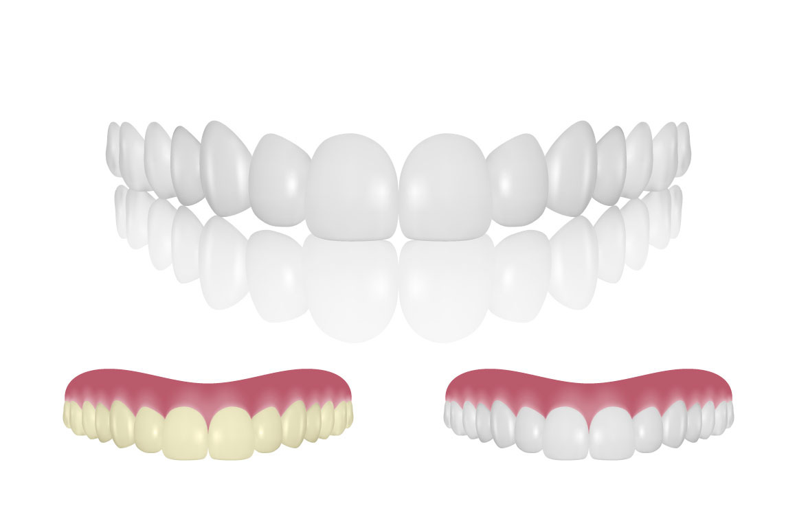 Teeth. Vector set., a Healthcare Illustration by Gomolach