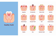Teeth problems. Medical infographic, a Graphic by Onyx