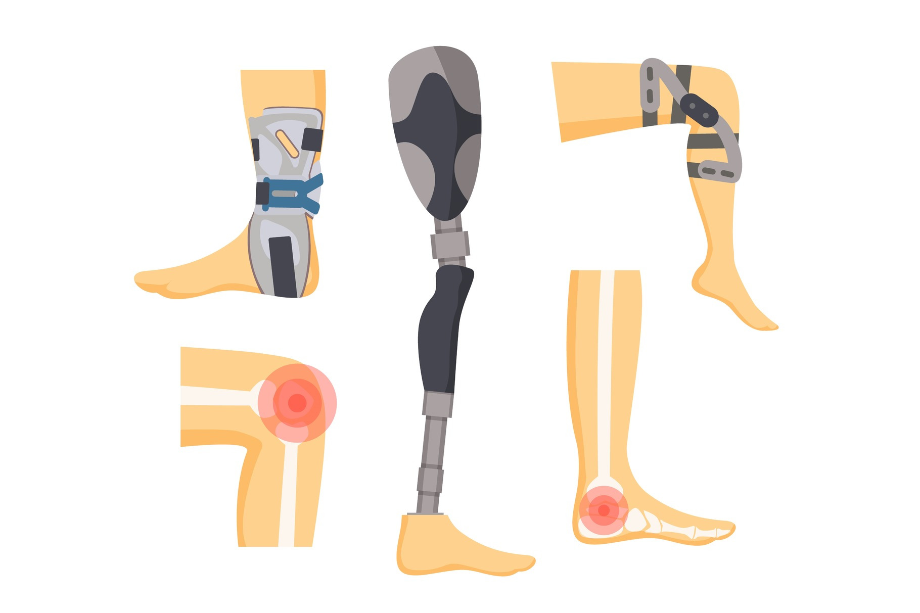 Pain in Joints and Orthopedic Retainers on Legs, an Object Graphic by ...