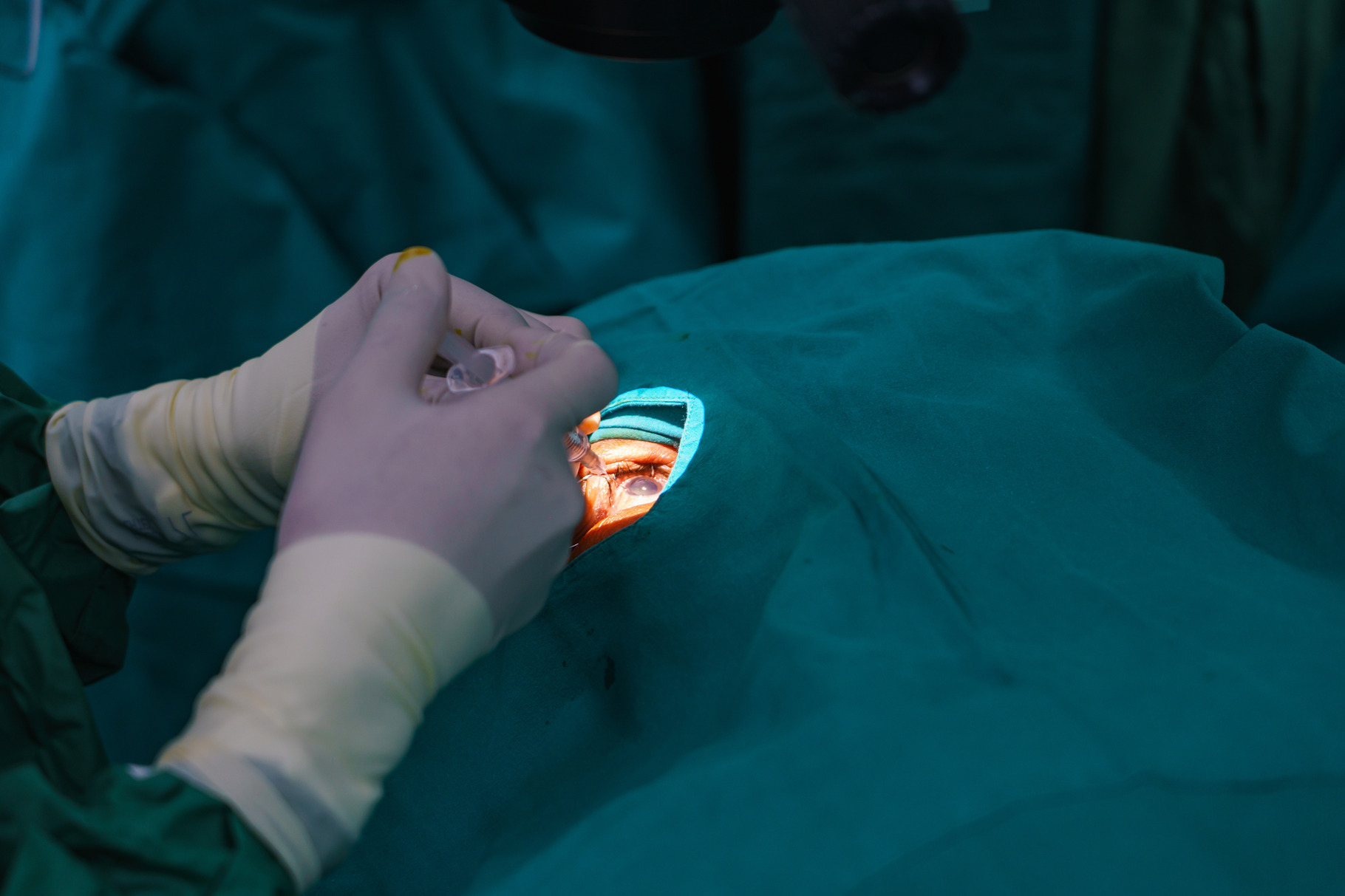 Doctor surgical operation eye lens replacement, intraocular lens ...