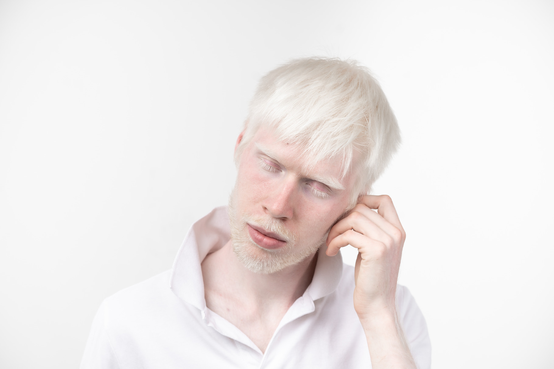 Portrait of an albino man in studio featuring albino, man, and guy, a ...