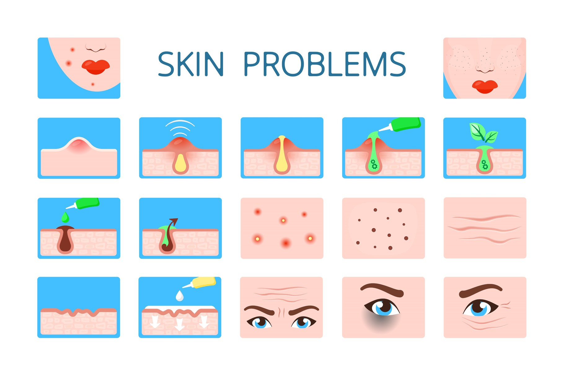 skin problem. hygiene infographic, a Healthcare Illustration by Multigon